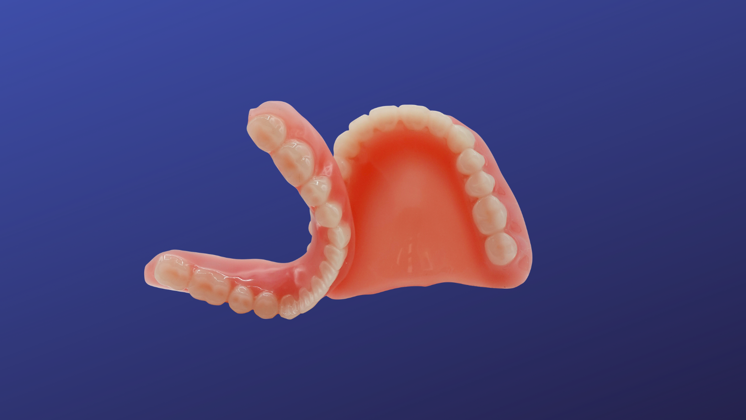 Go Digital With Physical Materials: An Extraoral Scanning Guide ...