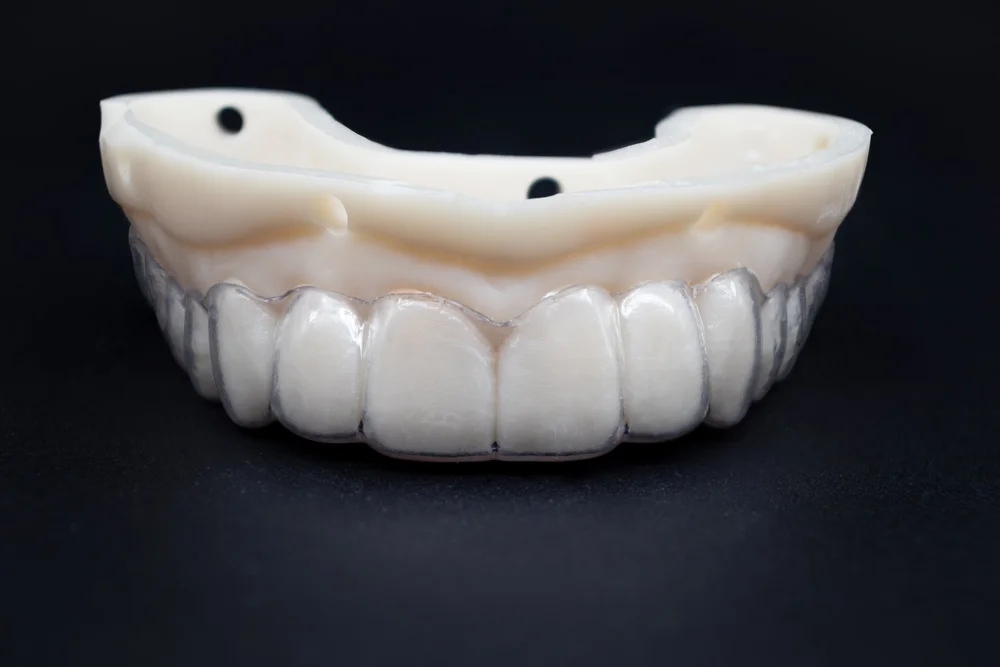 Occlusal guards — Paramount Dental Studio