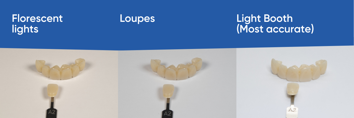 Lighting and Shade Protocol — Paramount Dental Studio