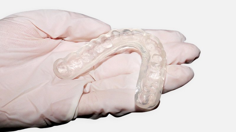 Occlusal Guards Types — Paramount Dental Studio