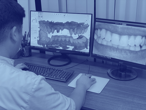 The Benefits of Smile Design — Paramount Dental Studio