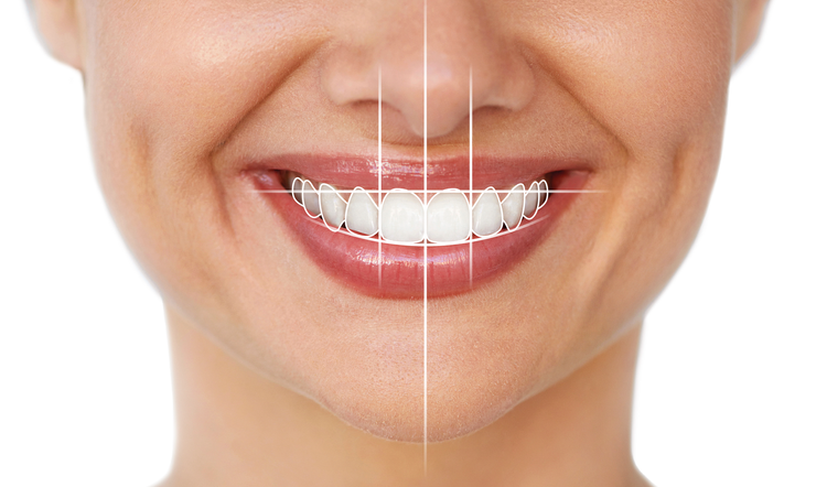 Smile design — Paramount Dental Studio