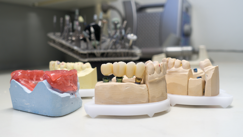 Lab work Overview — Paramount Dental Studio