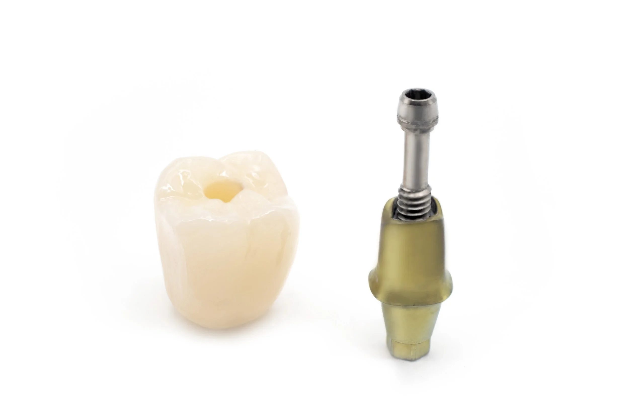 Retention Types — Paramount Dental Studio