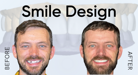 Case Study: Ortho, Restorative and Smile Design — Paramount Dental Studio