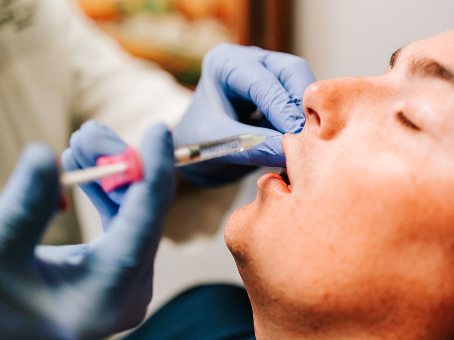 Filling in the Gaps: How Facial Fillers Can Transform Your Appearance ...