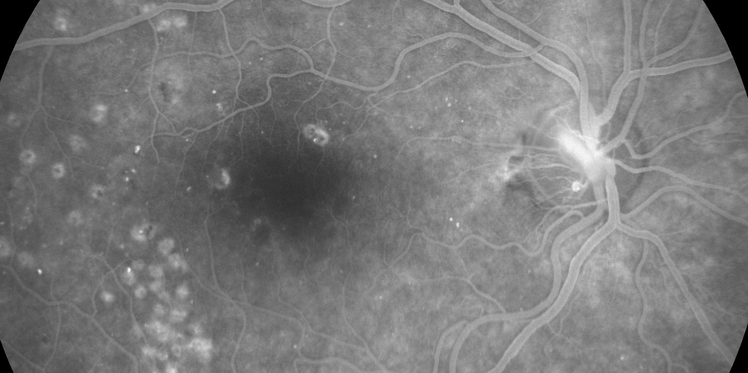 Retina Macula Institute