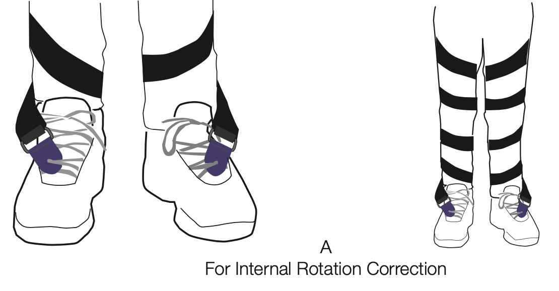Rotator | Quick & Easy Application