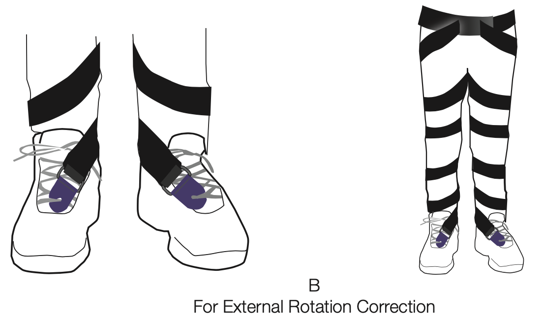 Rotator | Quick & Easy Application