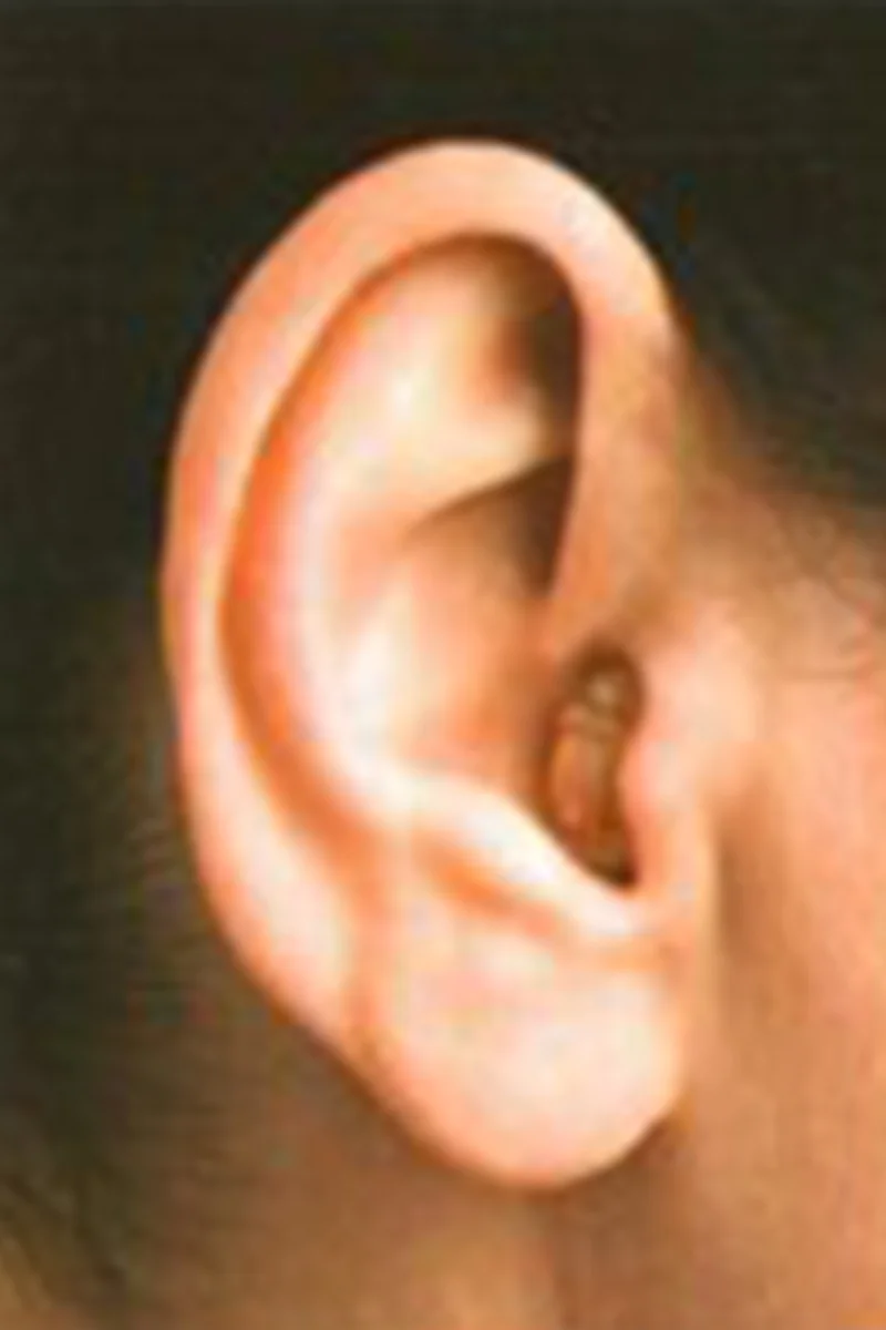 Hearing Aids | Phonak, Signia, Widex, Resound, Starkey, Oticon ...