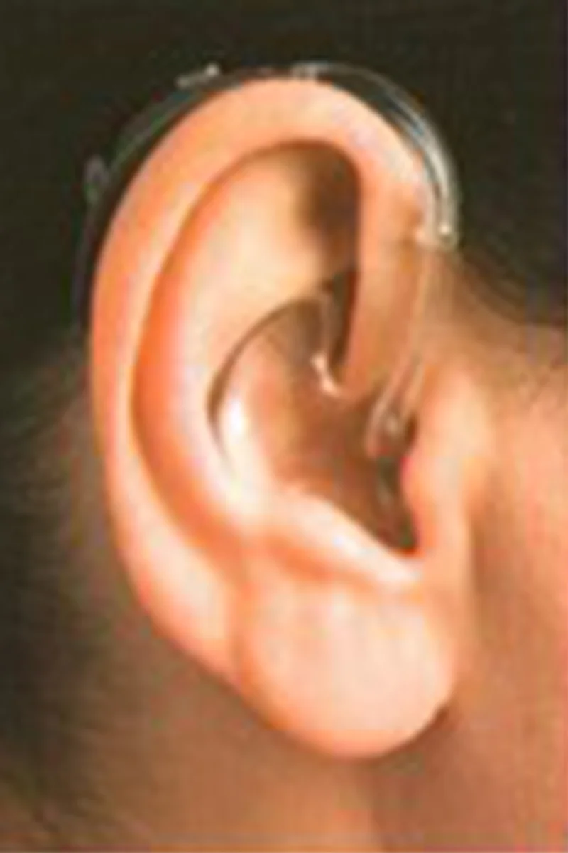 Hearing Aids | Phonak, Signia, Widex, Resound, Starkey, Oticon ...