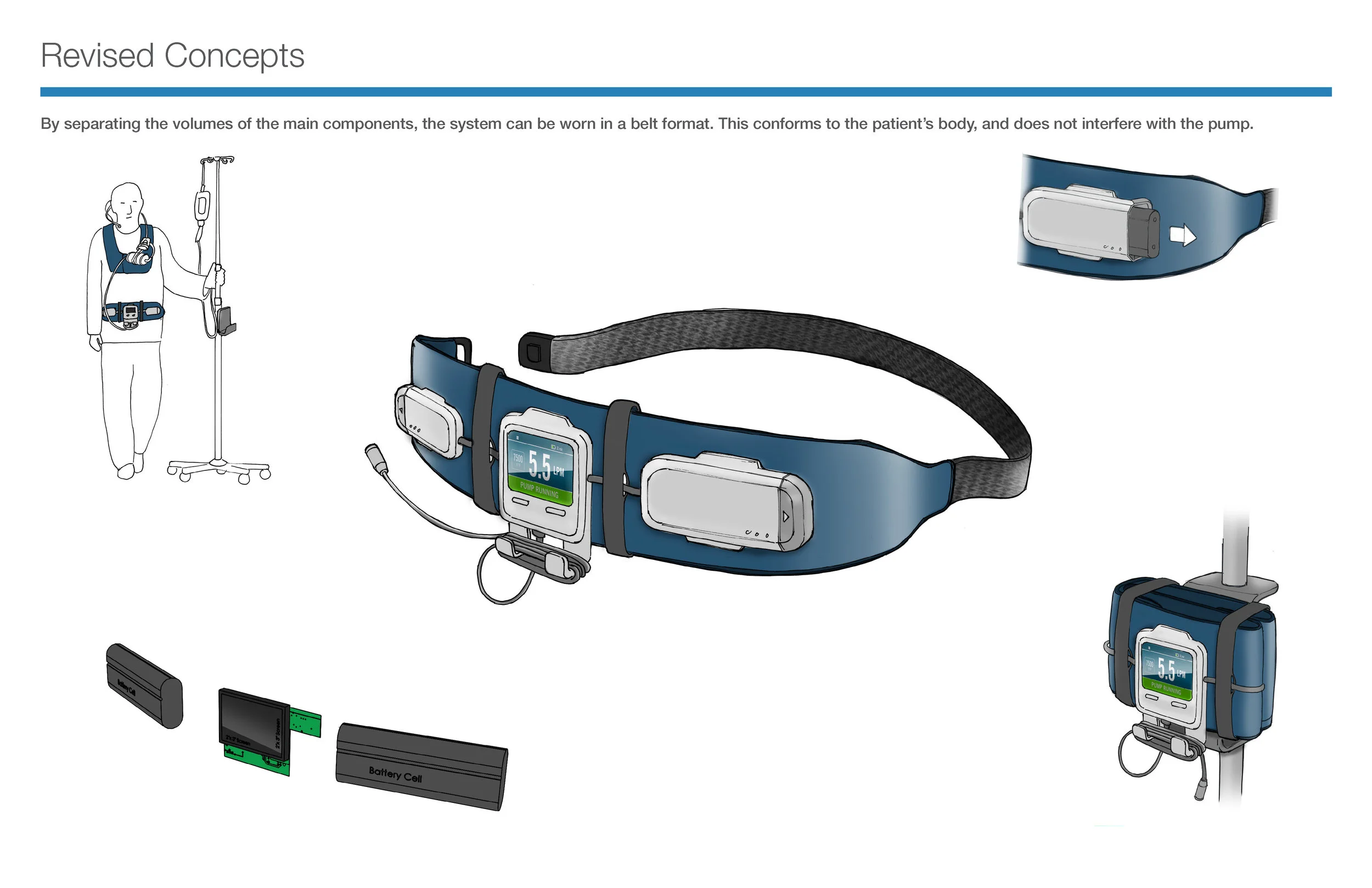 LifeSPARC — Tom Chavara