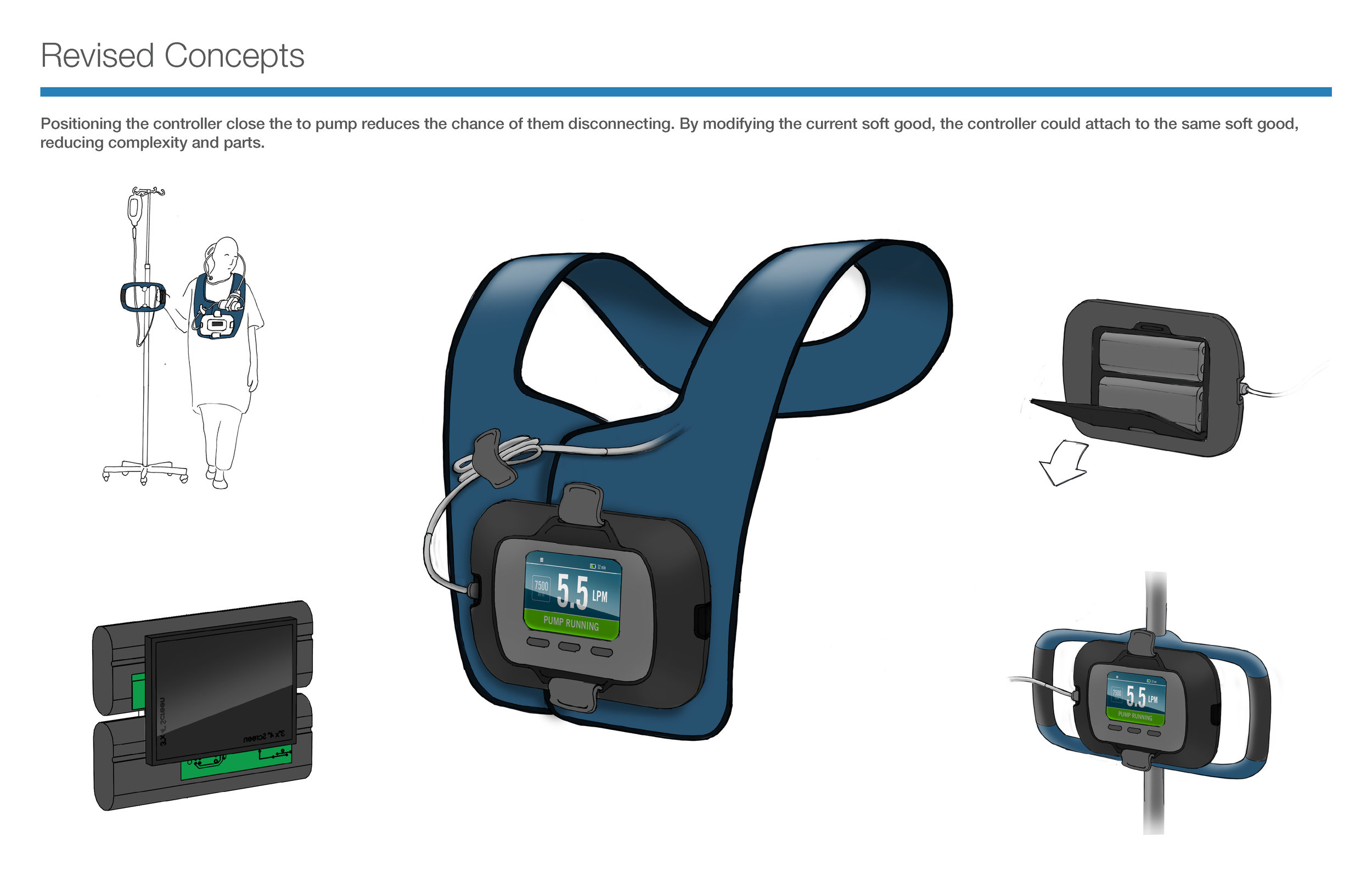 LifeSPARC — Tom Chavara