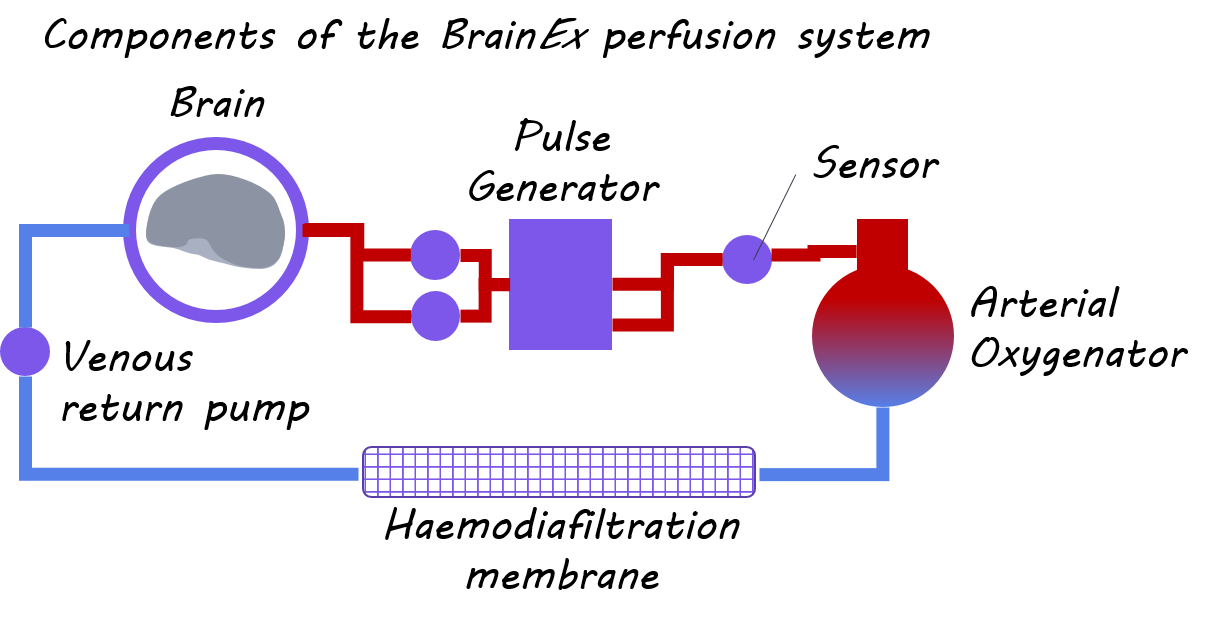 Restoration of Brain Circulation and Cellular Function after Death ...