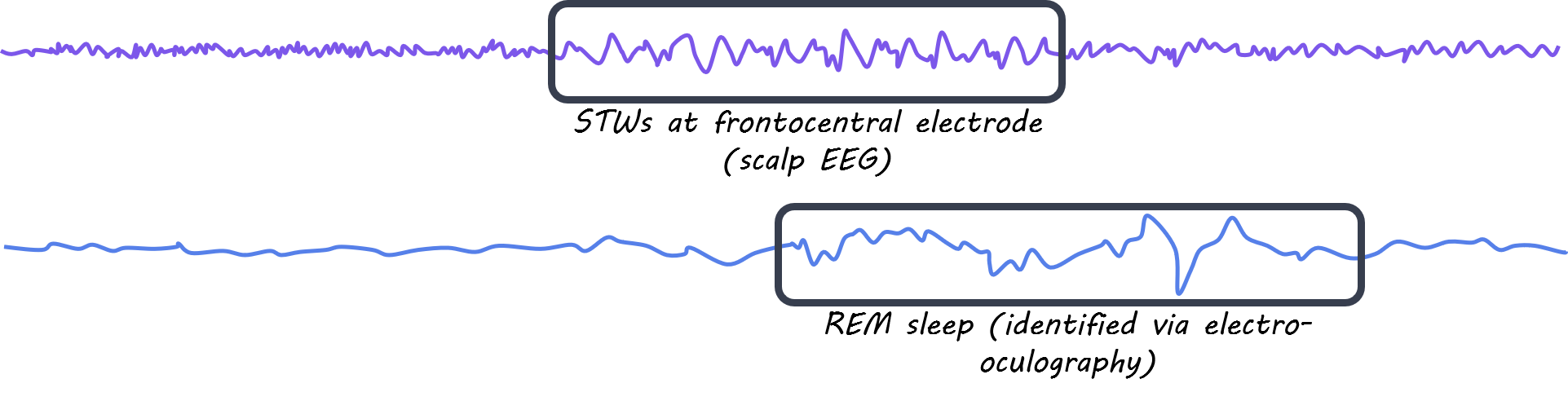 Sawtooth Wave Oscillations During REM Sleep — BrainPost | Easy-to-read ...