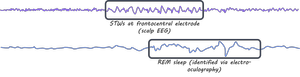 Sawtooth Wave Oscillations During REM Sleep — BrainPost | Easy-to-read ...