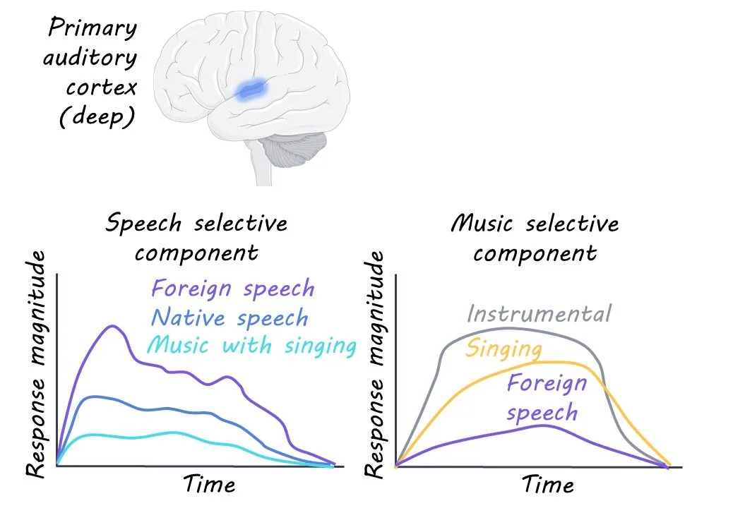 Secondary Auditory Cortex