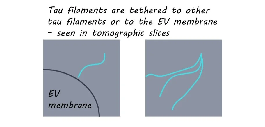 How Vesicles Shuttle Tau Filaments Throughout the Brain in Alzheimer's ...