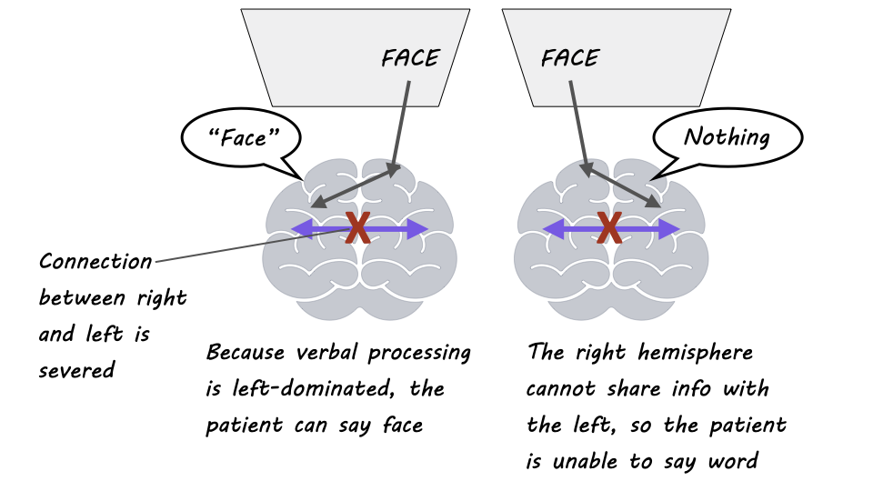 Myths and Facts: Left-Brain, Right-Brain Function, Learning Styles and ...
