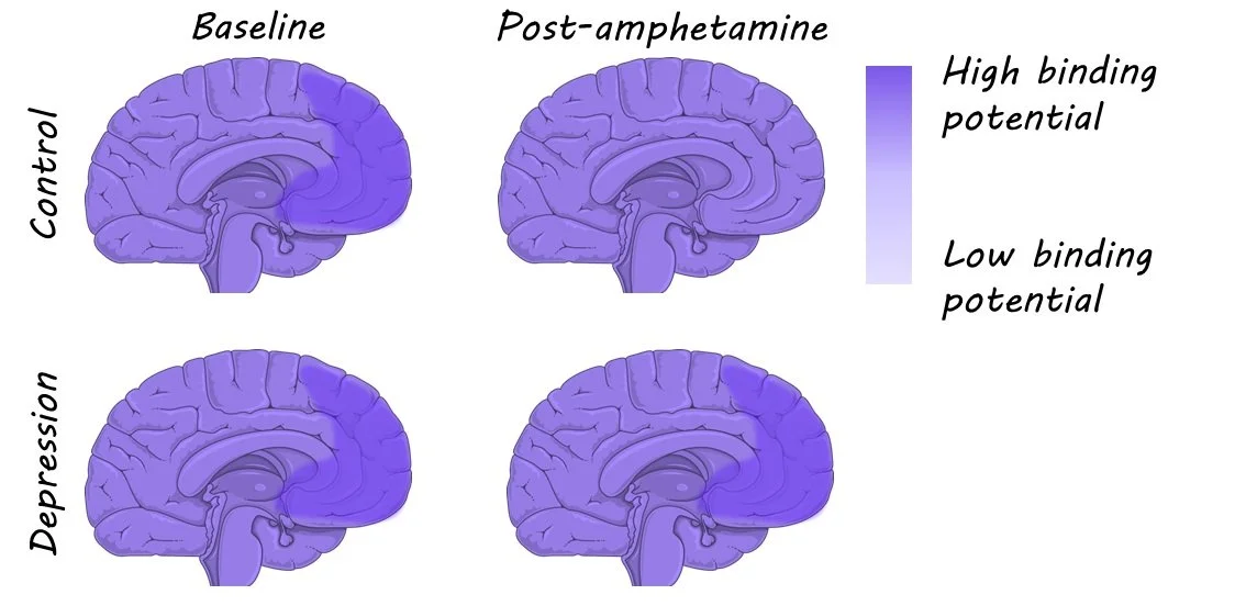 Amphetamine Effects On The Brain