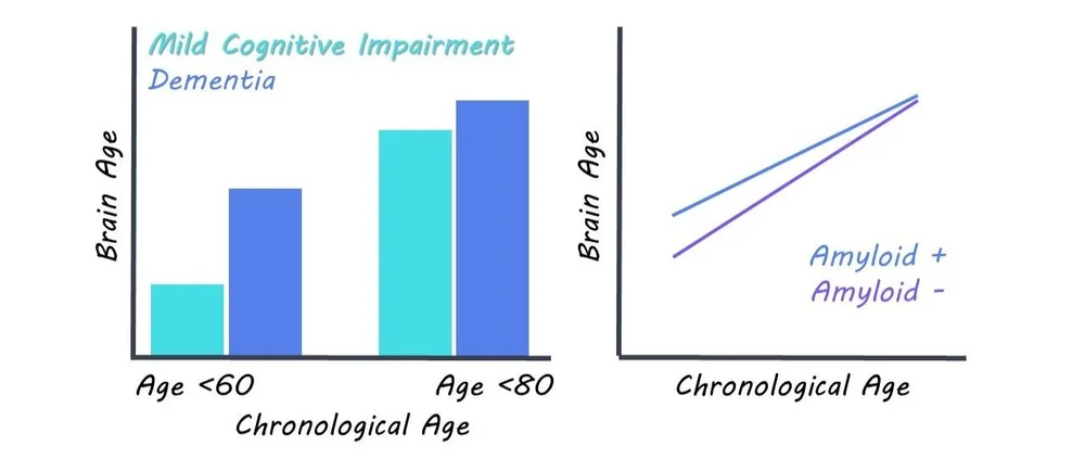 Predicting Cognitive Decline Using Brain Age — BrainPost | Easy-to-read ...