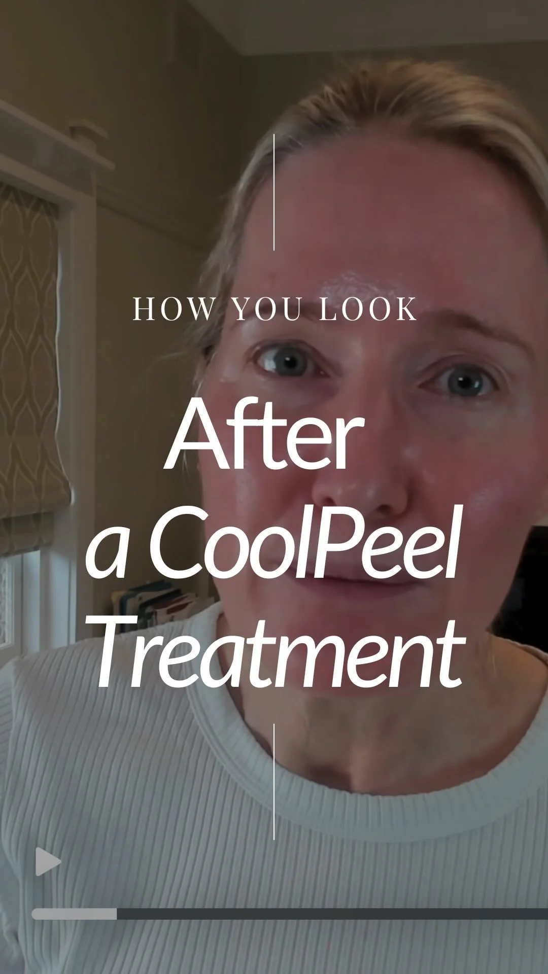 Eye Area Skin Treatments Sydney – Dr Liz Dawes-Higgs — Dr Liz Dawes-Higgs