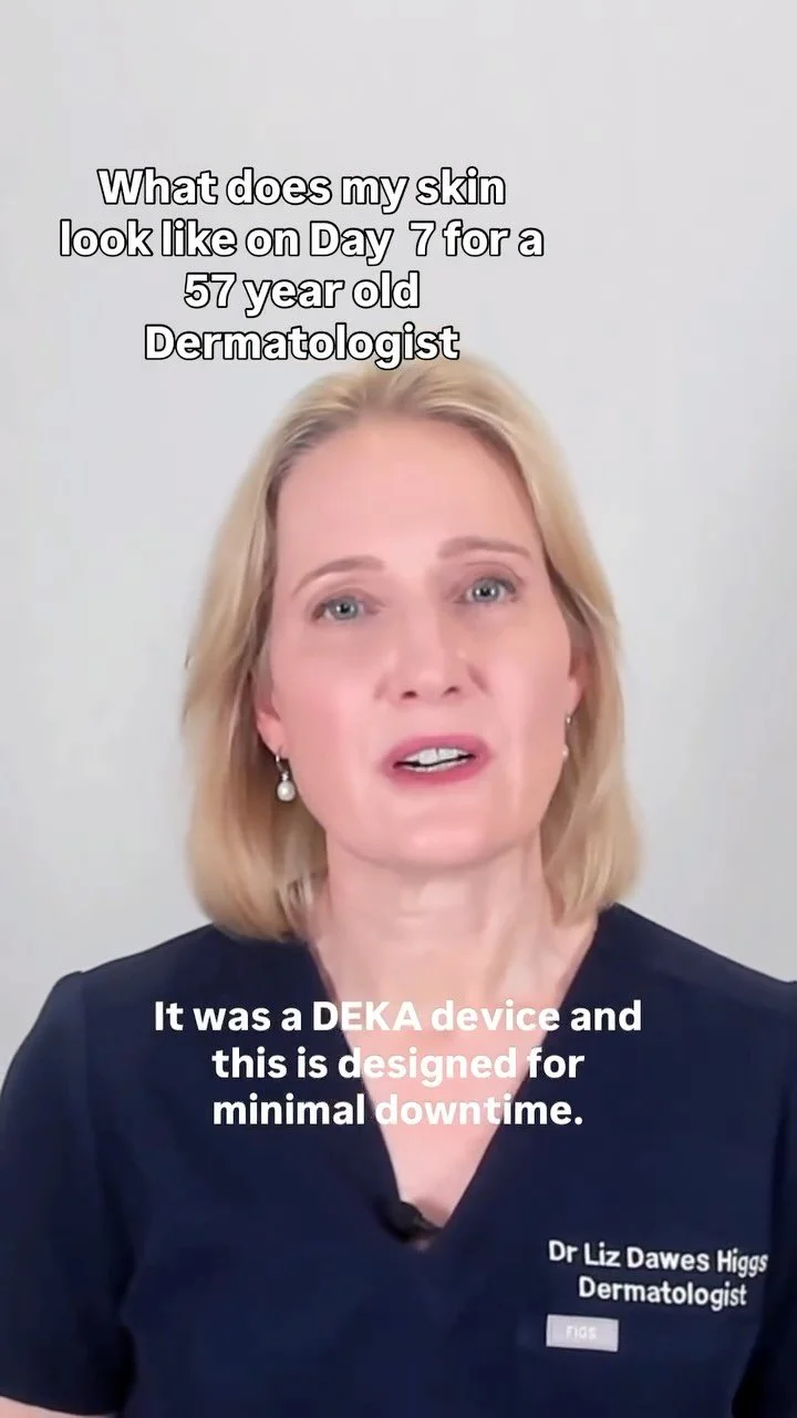 Xanthelasma Treatment Sydney | Dr Liz Dawes-Higgs Dermatologist — Dr ...