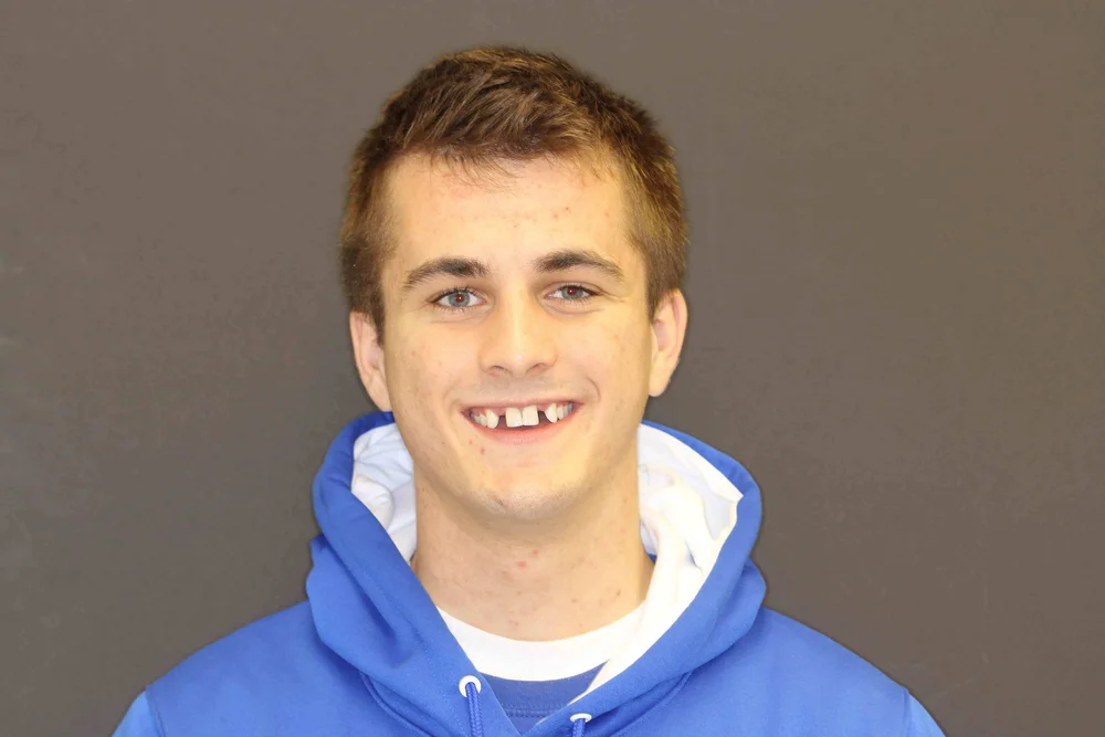 Implants — Utah Valley Periodontics & Dental Implants
