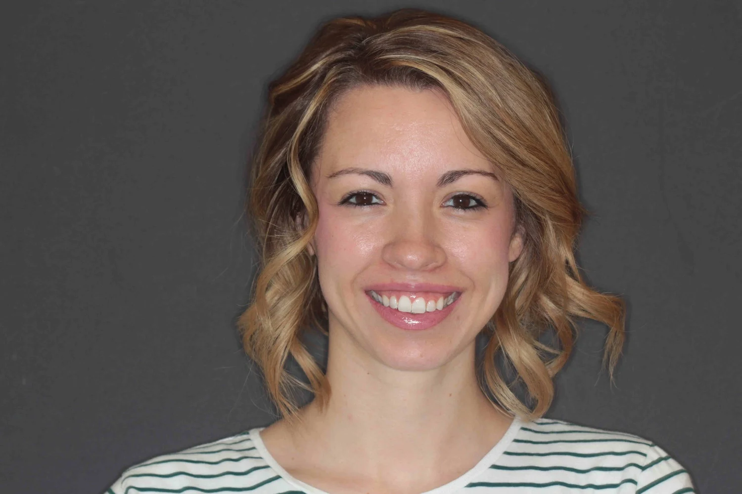 Lip Switch — Utah Valley Periodontics & Dental Implants