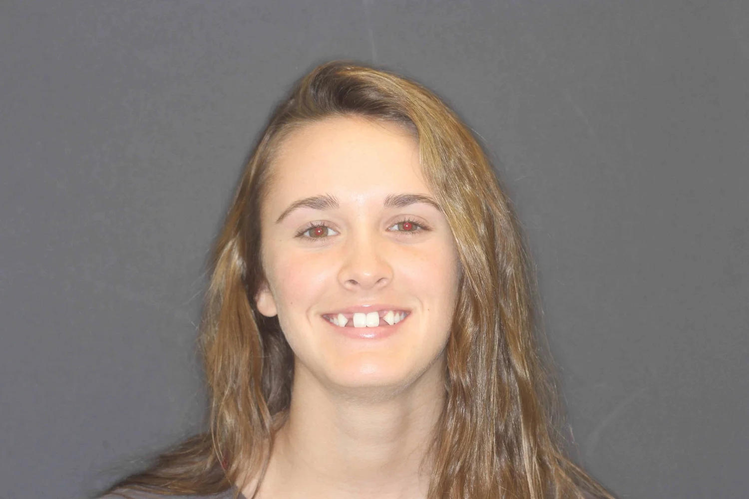 Implants — Utah Valley Periodontics & Dental Implants