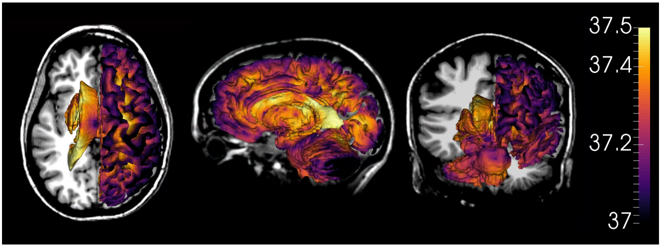 Projects — Fleischer Lab