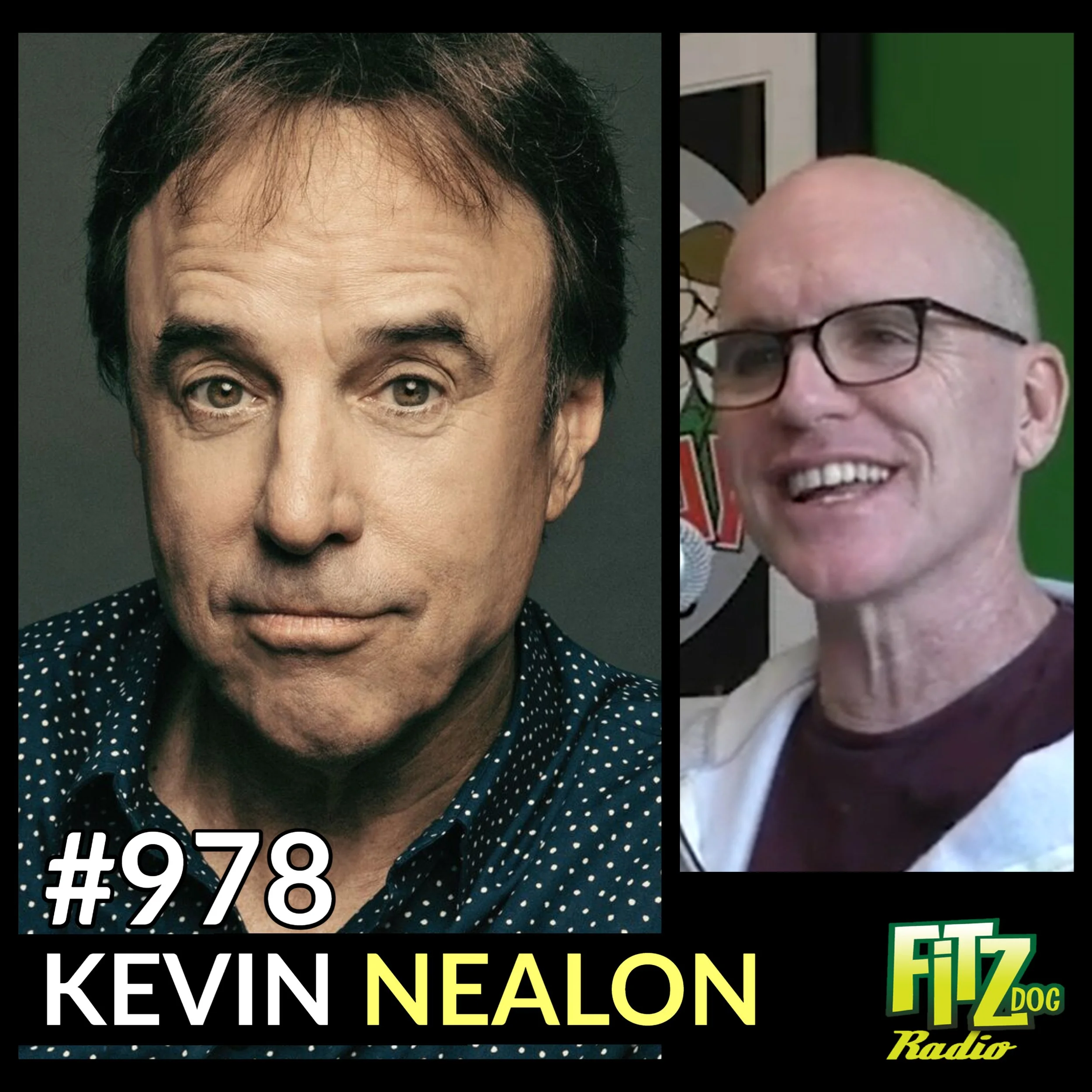 Kevin Nealon Hair Transplant