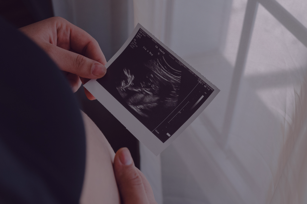 When to Schedule Your First Pregnancy Ultrasound — Wellington Obstetrics