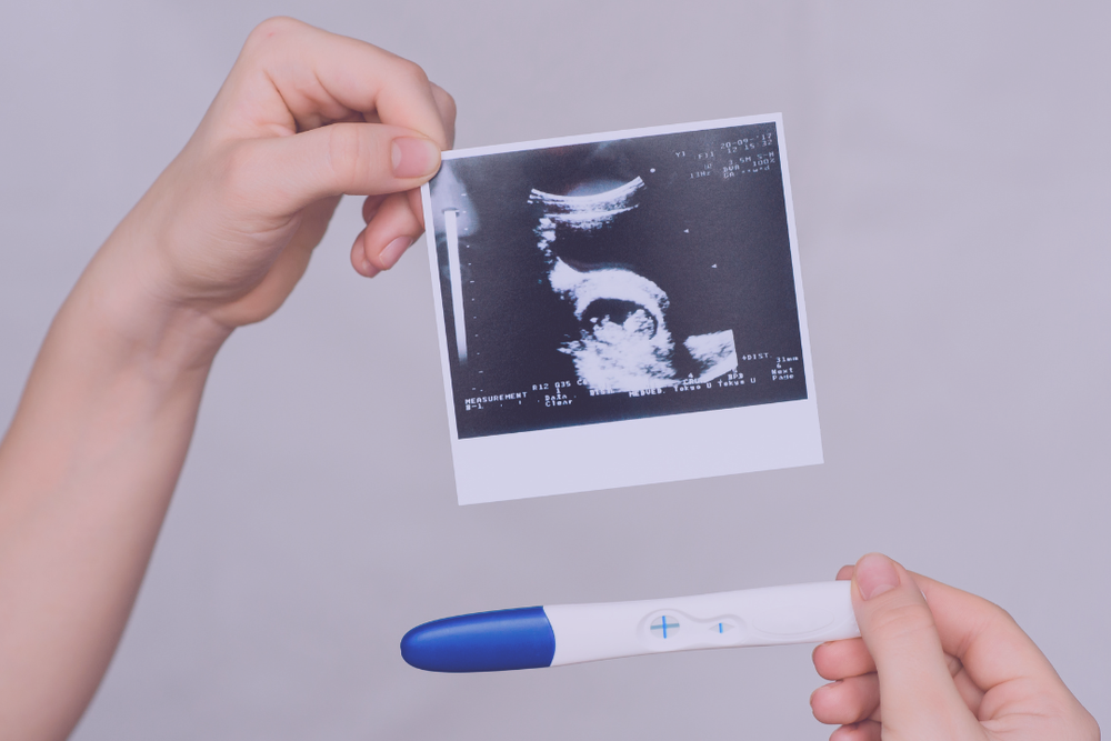 Early Scans: What to expect — Wellington Obstetrics