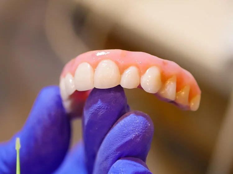 Services — Ceramics West Dental Lab