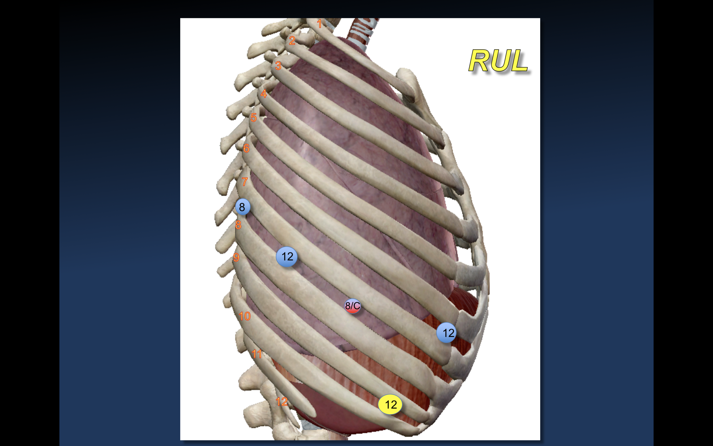 Surgical Videos - Robotic Surgery — Robotic Thoracic Surgery