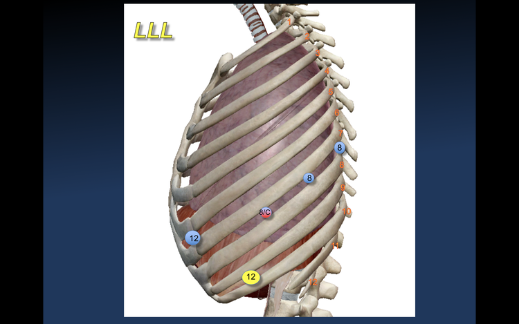 Surgical Videos - Robotic Surgery — Robotic Thoracic Surgery