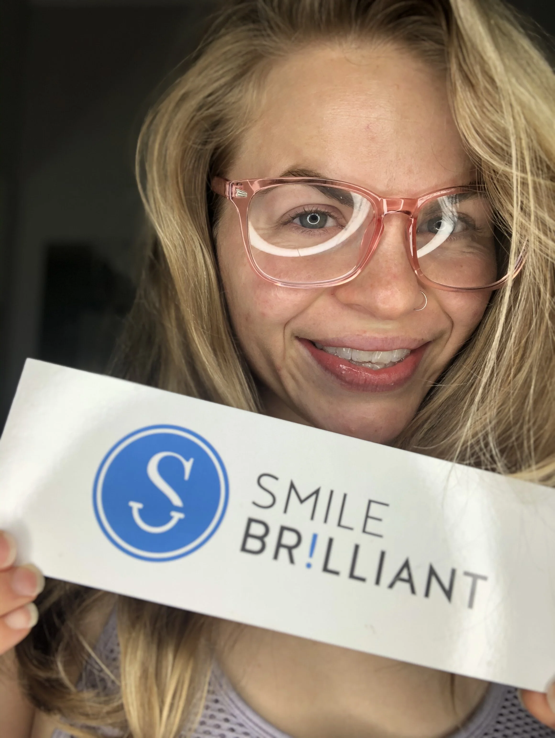 My First Teeth Whitening Experience: Smile Brilliant Results ...
