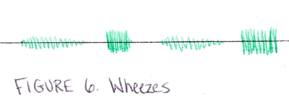 Seeing the Sounds: How to Use Visual Stethoscopes — AMPHL