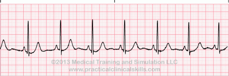 Matters of the Heart - Sinus Rhythms — PatMac,RN