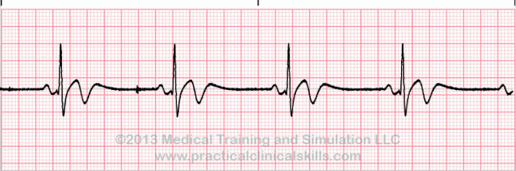 Matters of the Heart - Sinus Rhythms — PatMac,RN