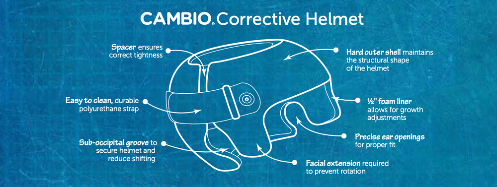 Orthotic Care Services | Helmet Program