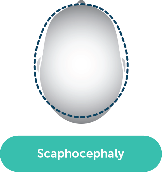 Orthotic Care Services | Helmet Program