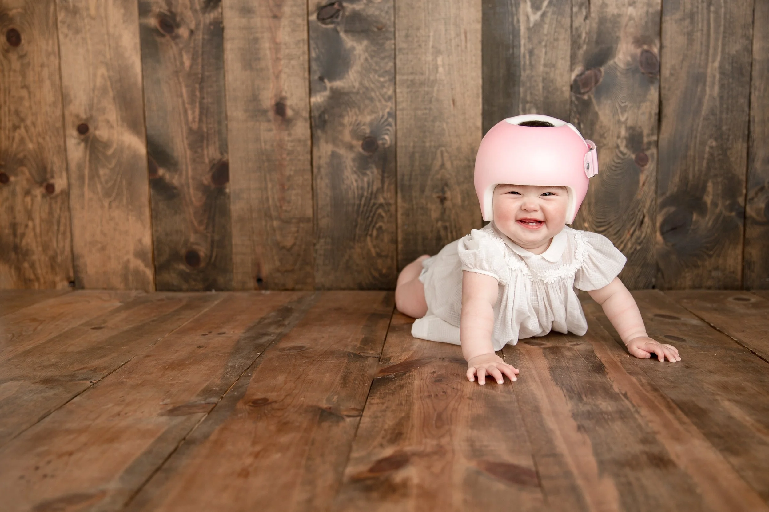 Orthotic Care Services | Helmet Program