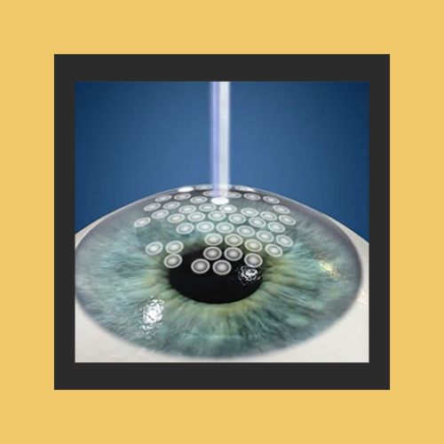 Services — Trojan Eye Center