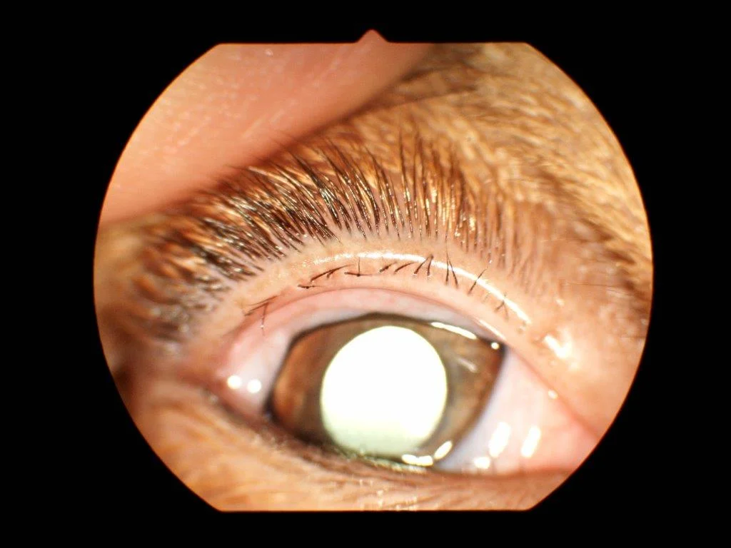 Distichia — ACVO Public