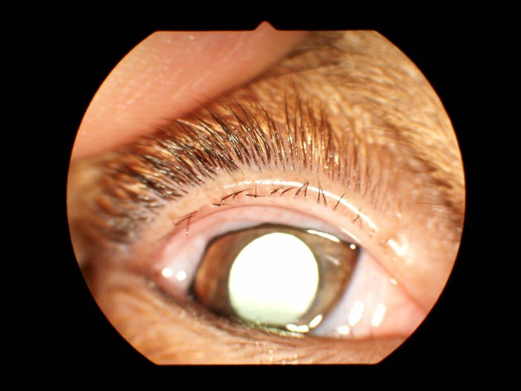 Distichia — ACVO Public