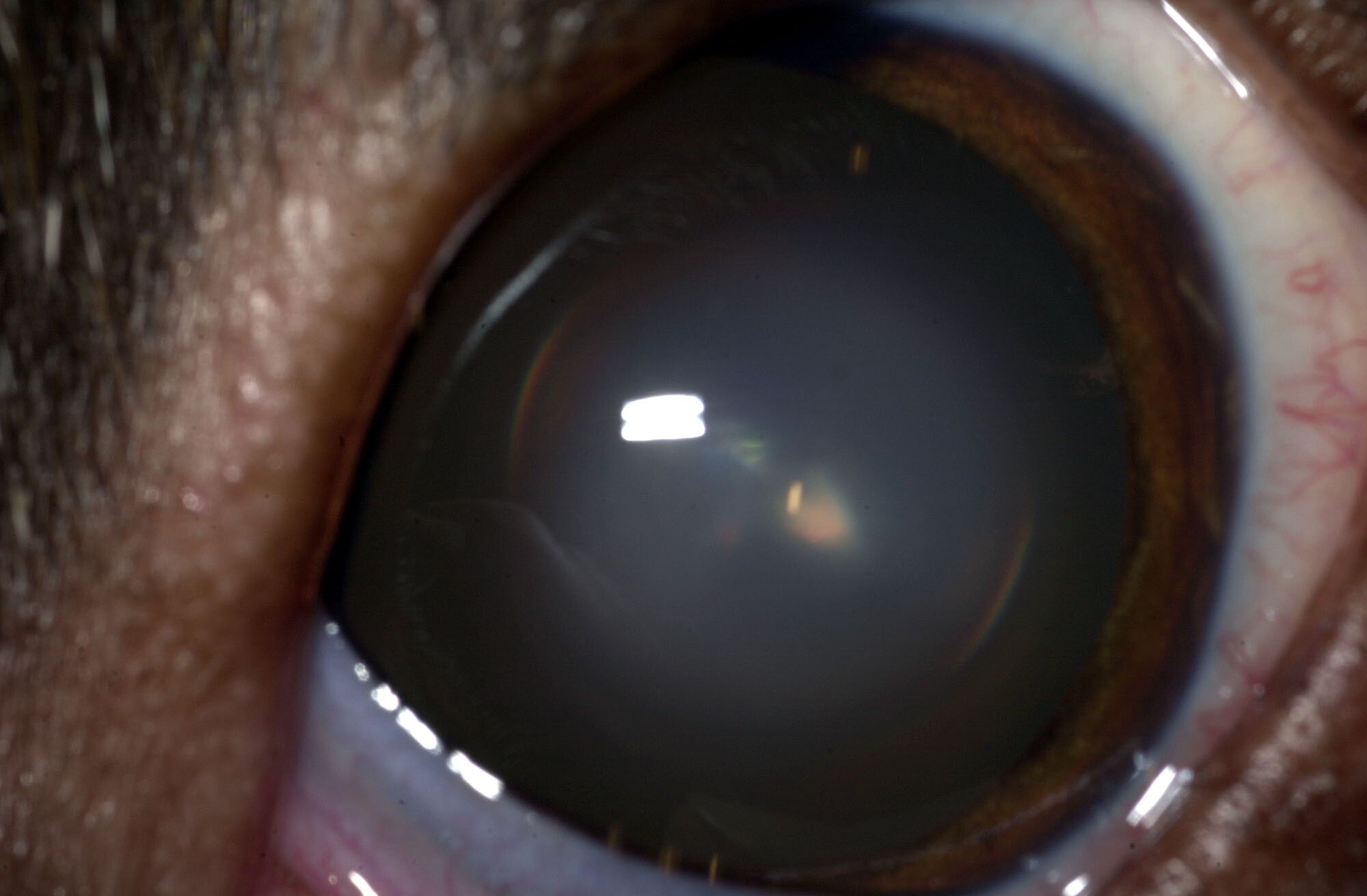 Signs of Age-Related Change in the Eye — ACVO Public