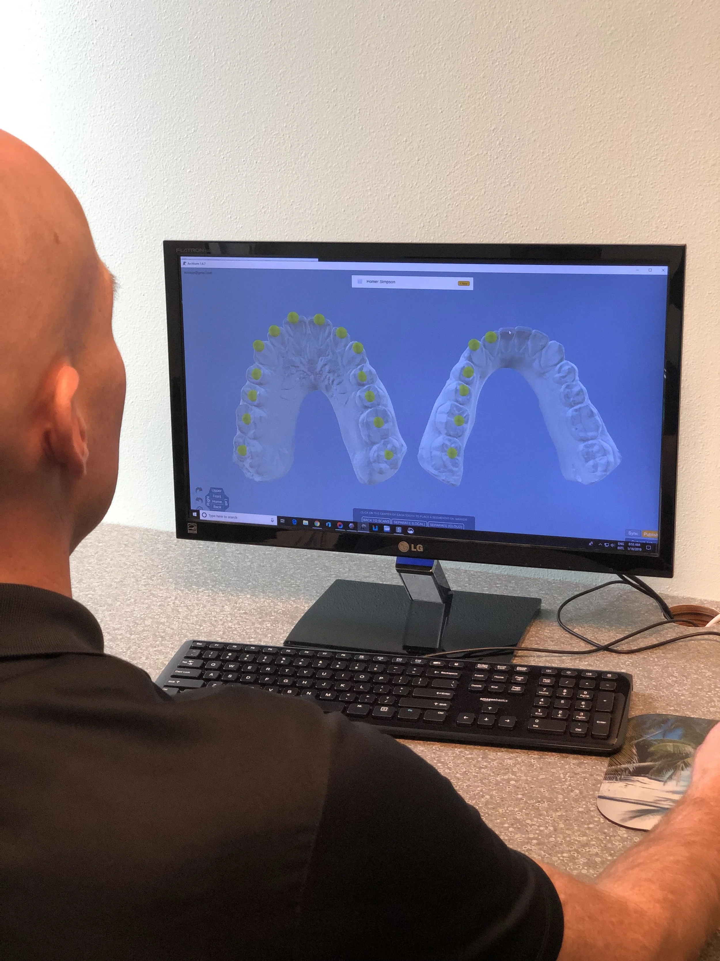 Aligner Solutions | Clear Aligner Treatment Services | alignersolutions ...