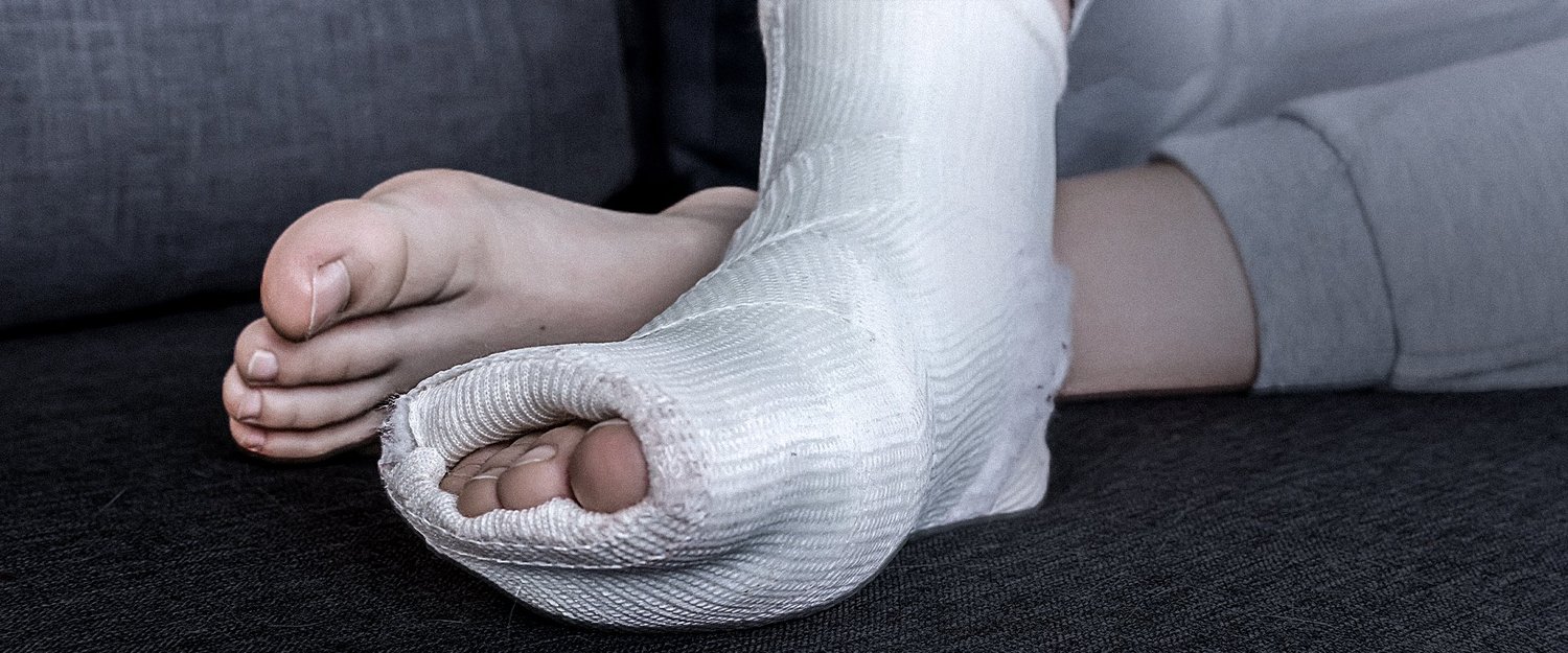 Physical Therapy for Broken Foot in Brooklyn, NY — Evolve PT